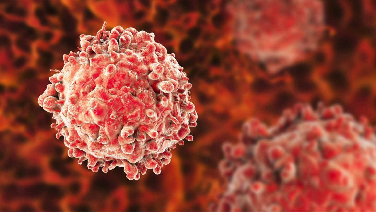 How To Cure Leukemia | AllCancer